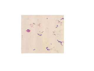 Streptococcus 2 Pptx