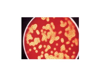 Streptococcus 2 Pptx