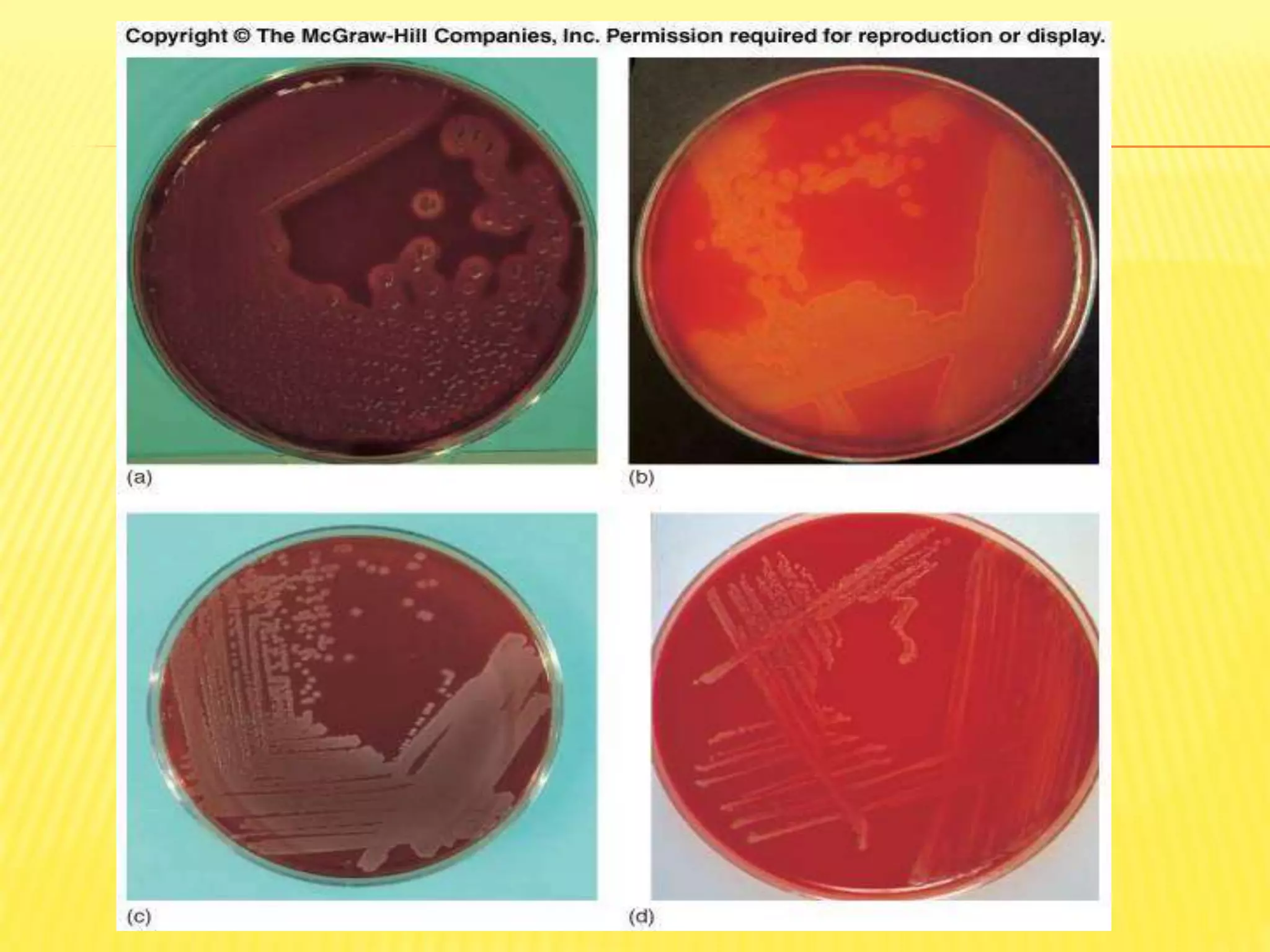 Streptococcus | PPTX