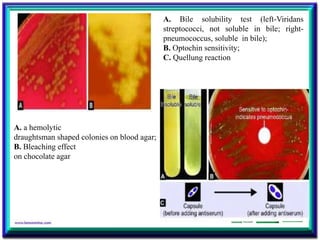 Streptococcus | PPTX