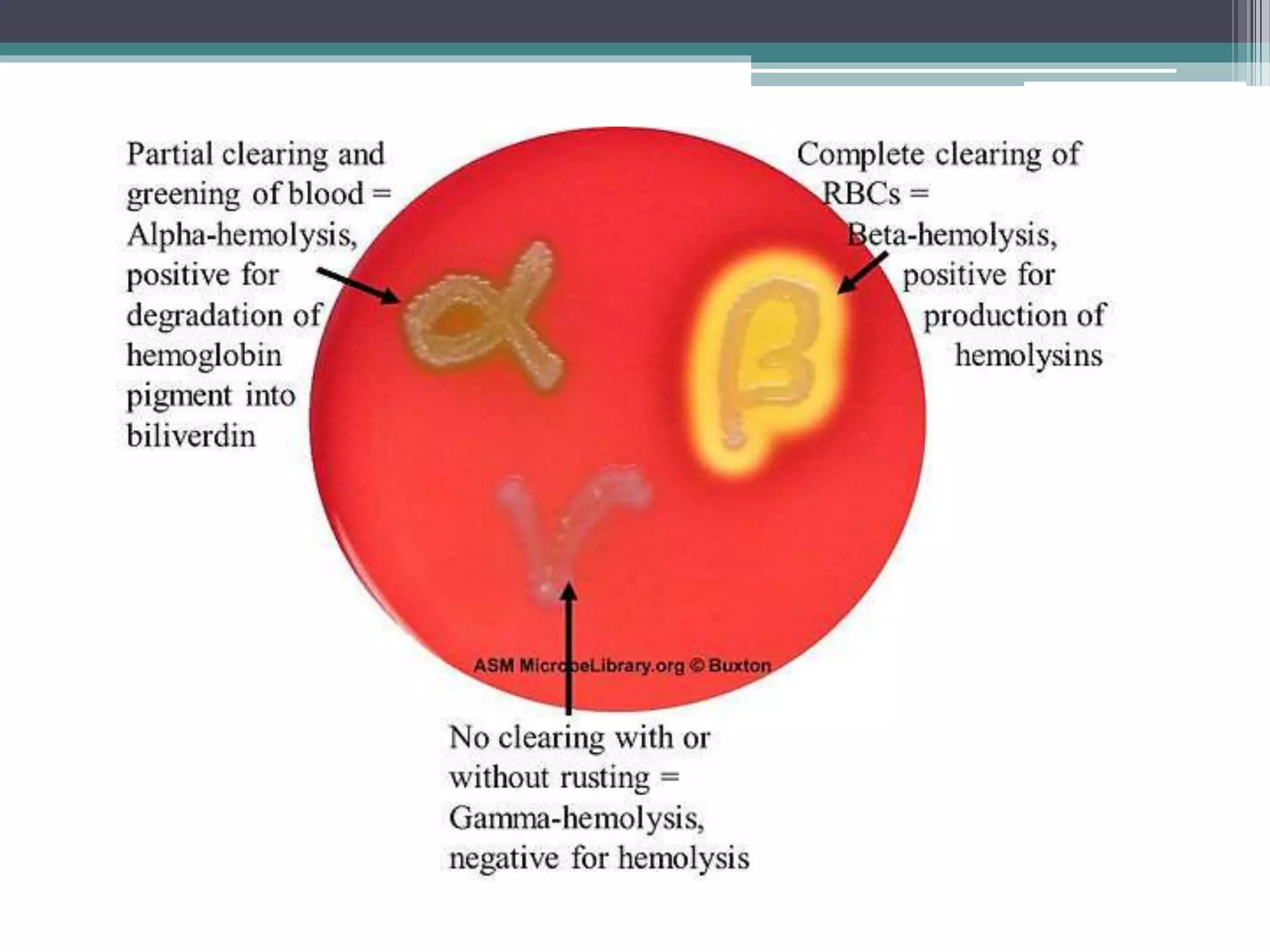 STREPTOCOCCUS.pptx