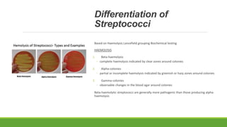 Introduction to streptococcus and a brief review on its species | PPTX