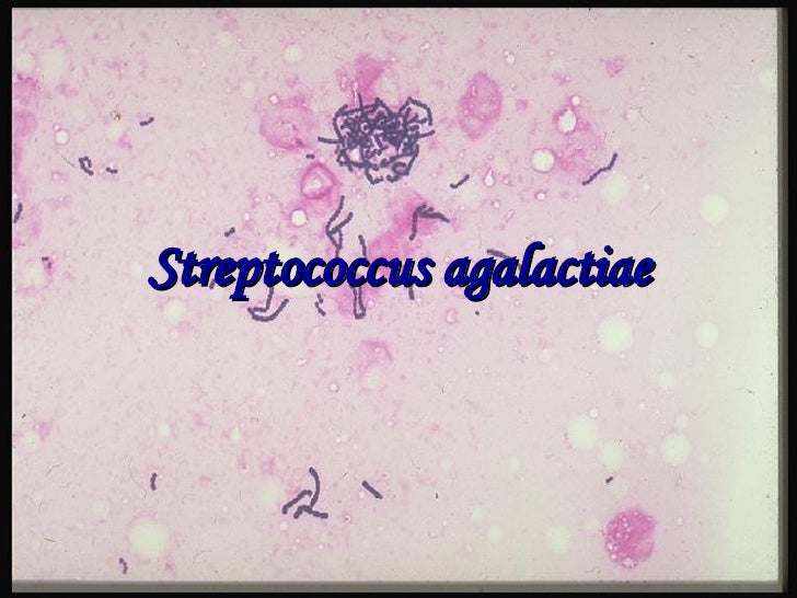 Streptococcus Agalactiae Gram Stain