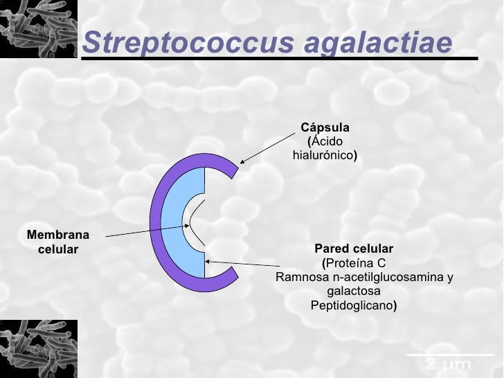 Streptococcus agalactiae