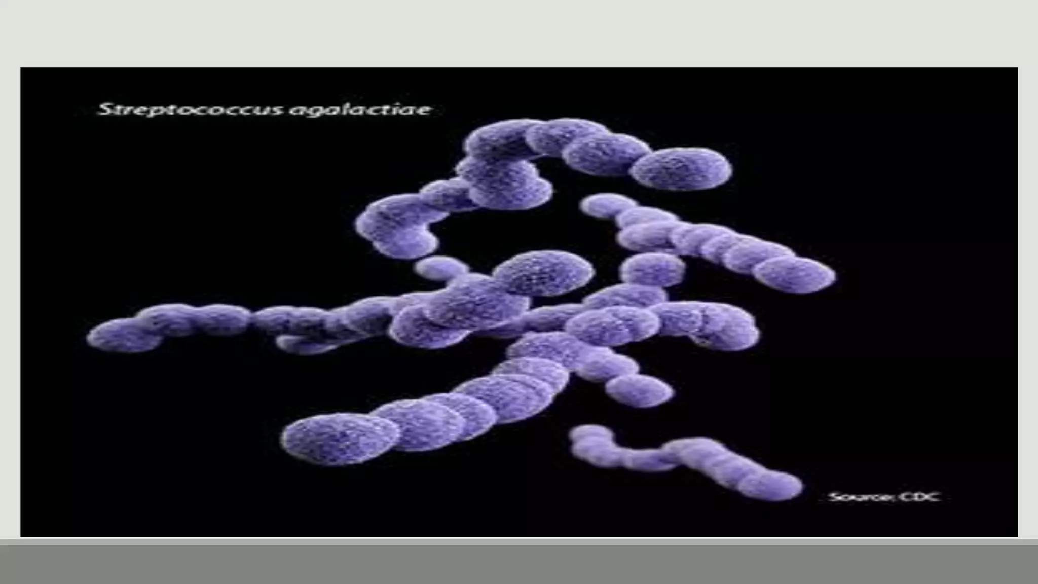 Streptococcus agalactiae presentation.pptx