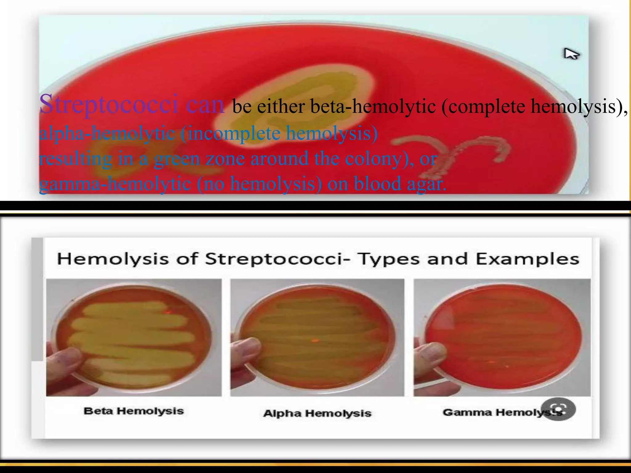 streptococci classification.pdf