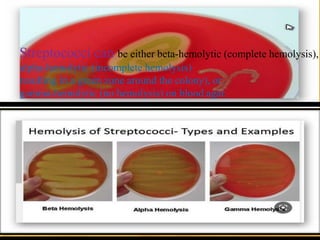 streptococci classification.pdf