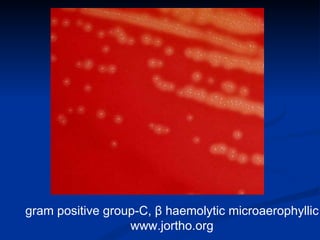 Streptococcus constellatus | PPT