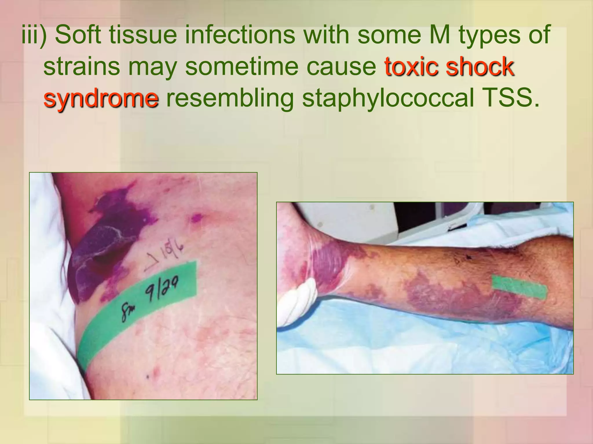 Streptococcus & Enterococcus by Dr. Rakesh Prasad Sah | PPTX