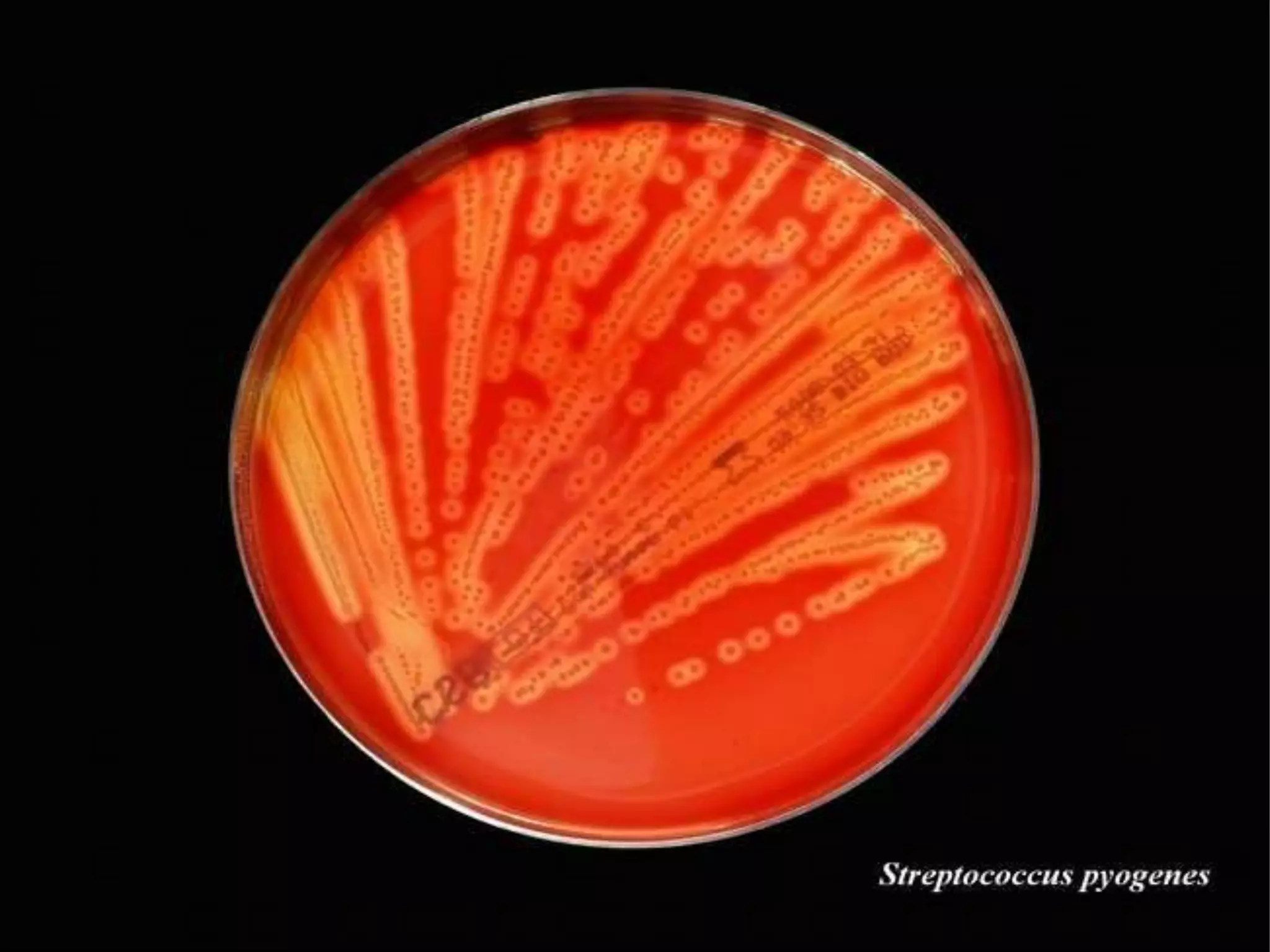 Streptococcus & Enterococcus by Dr. Rakesh Prasad Sah | PPTX