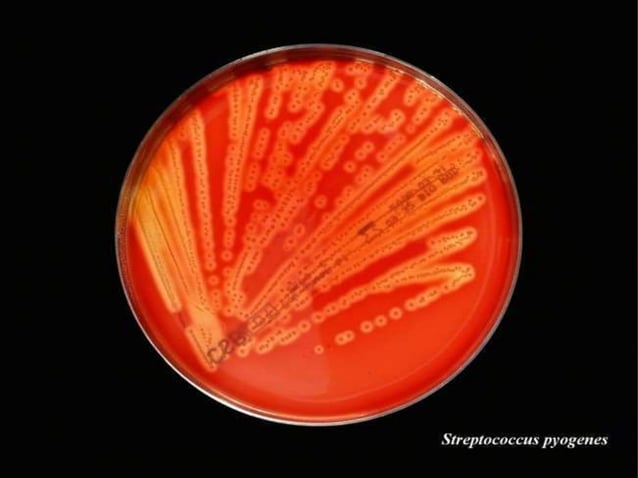 Streptococcus & Enterococcus by Dr. Rakesh Prasad Sah | PPTX