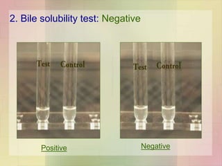 Bile Solubility Test