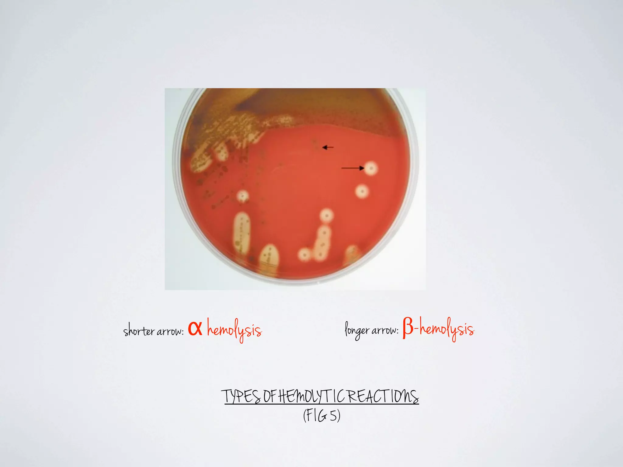 Streptococcus mutans & other streptococci | PDF