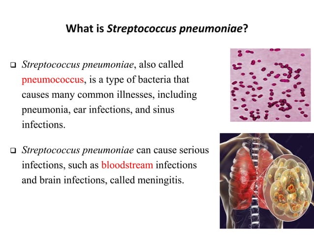 Streptococcus pneumoniae