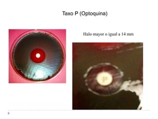 Streptococcus pneumoniae | PPTX