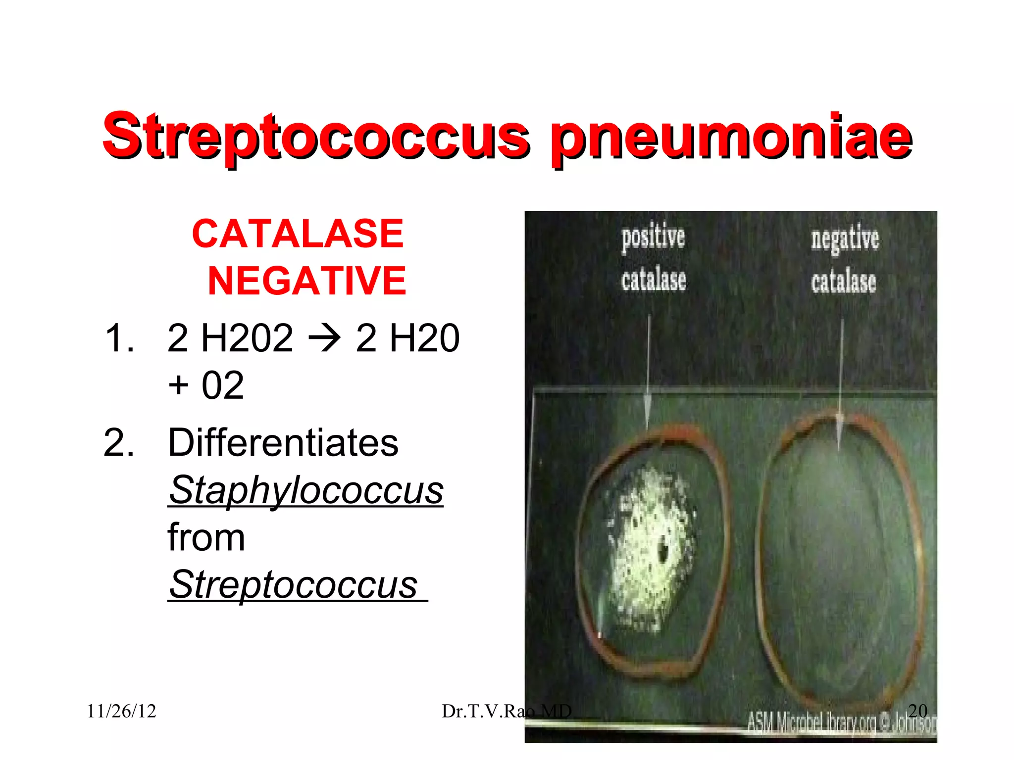 Streptococcus pneumoniae | PPT