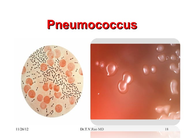 Streptococcus pneumoniae | PPT