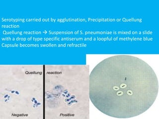 Streptococcus pneumoniae by Dr. Rakesh Prasad Sah | PPT