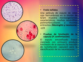 Streptococcus pneumoniae | PPTX