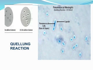 Streptococcus pneumoniae | PPTX
