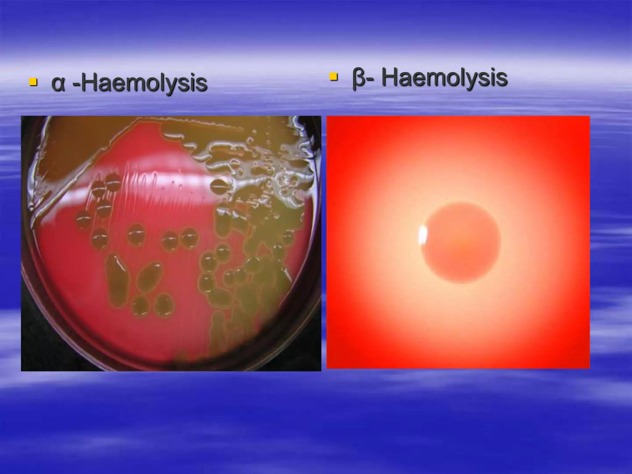 Streptococcus pneumoniae | PPT