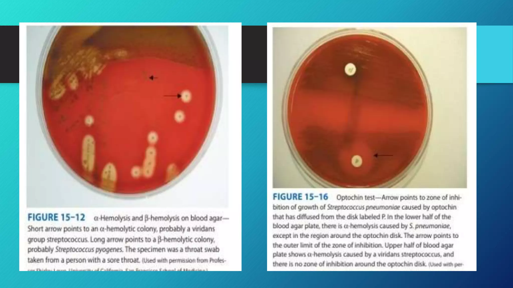 Streptococcus Pneumoniae Bacteria Microbiology Lecture | PPTX