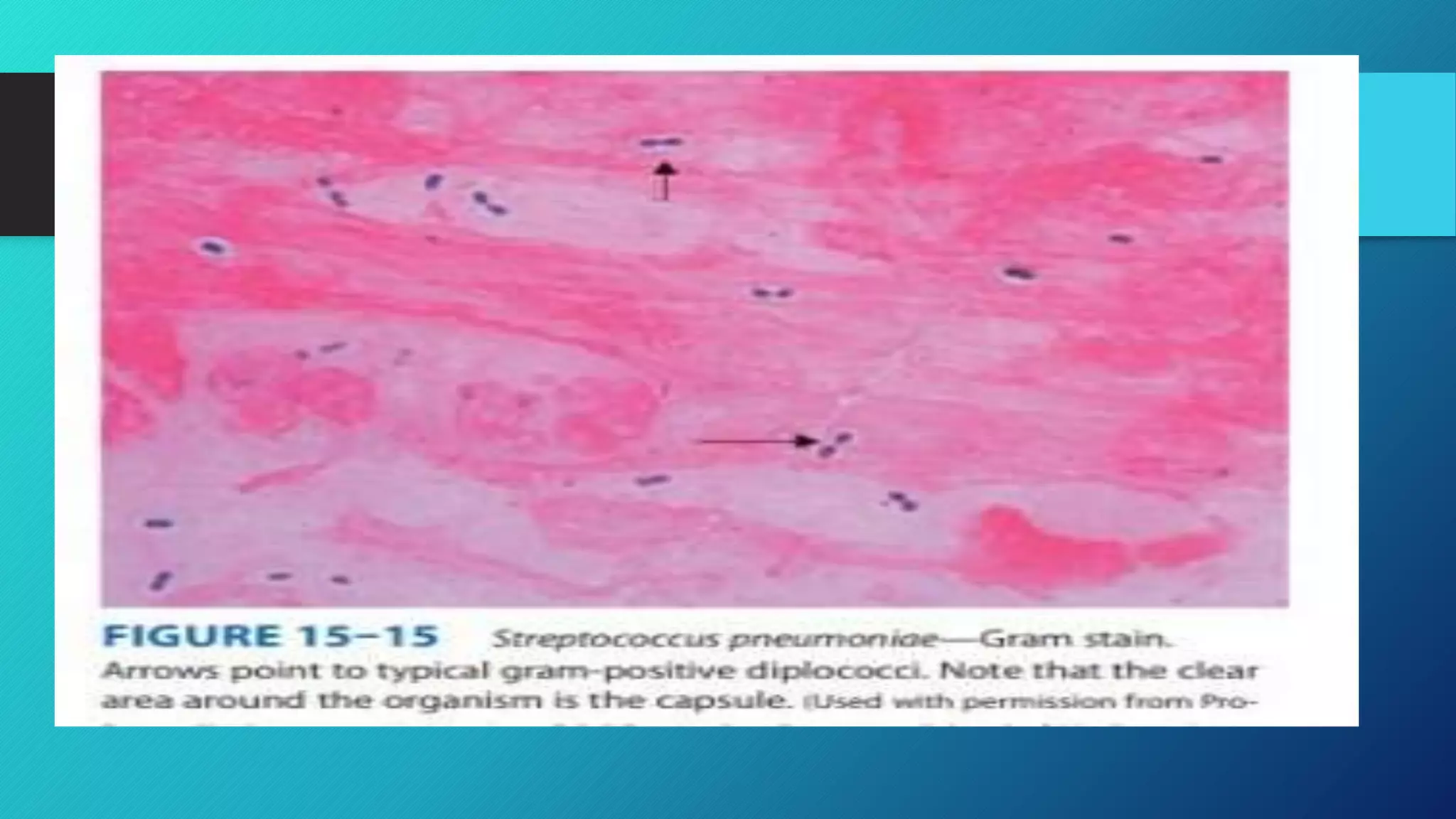 Streptococcus Pneumoniae Bacteria Microbiology Lecture | PPTX
