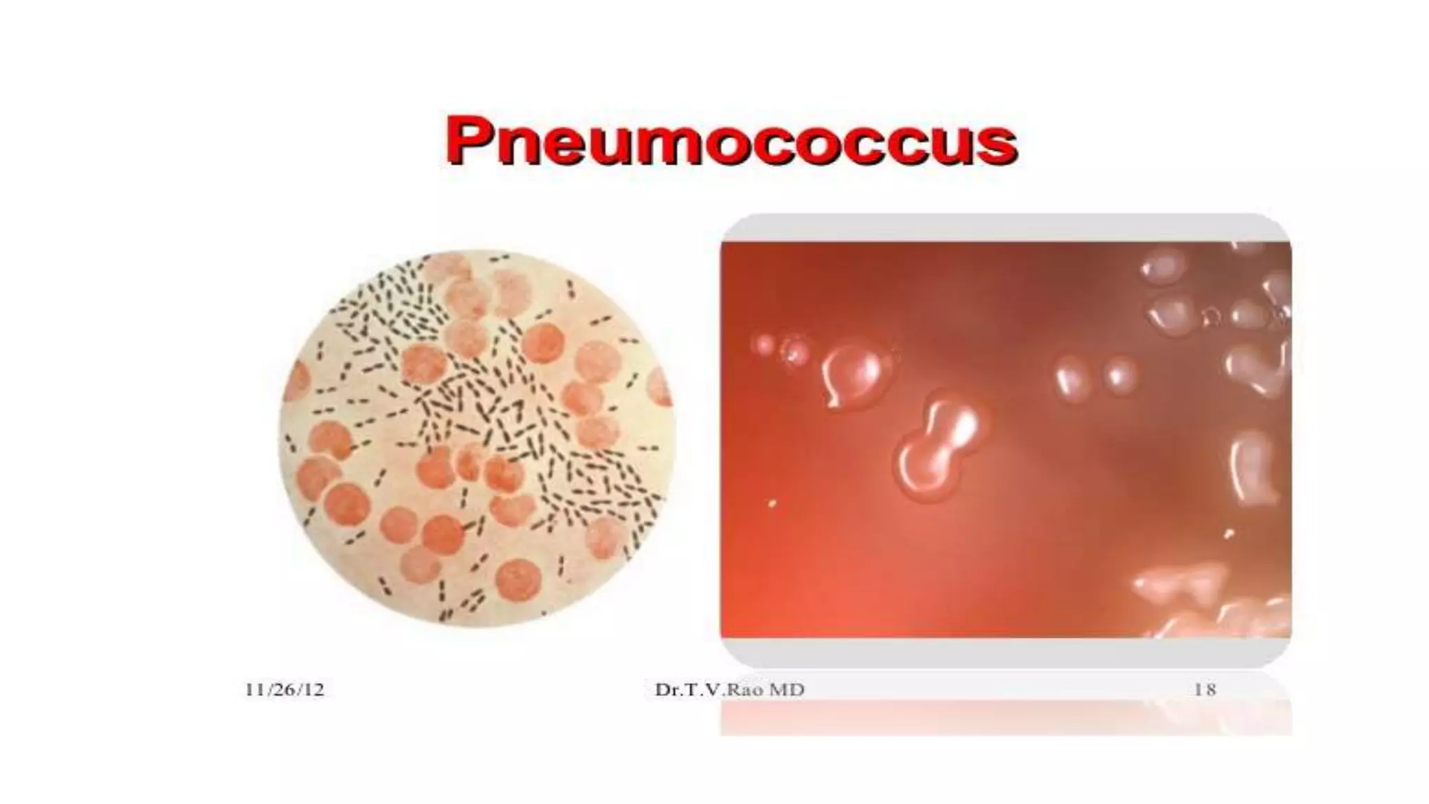 Streptococcus pneumoniae 2013.pptx