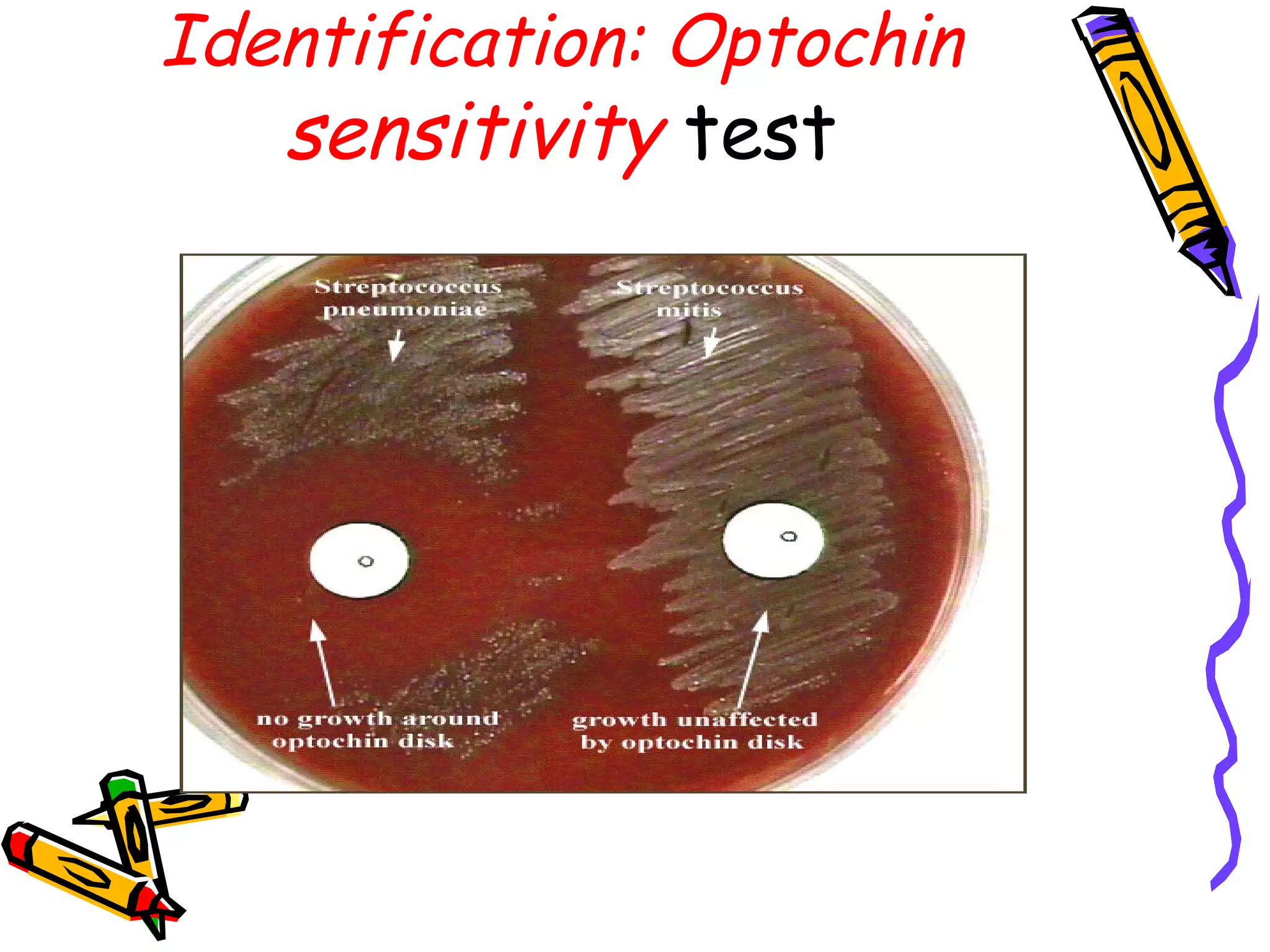 Streptococcus pneumoniae mbbs | PPT