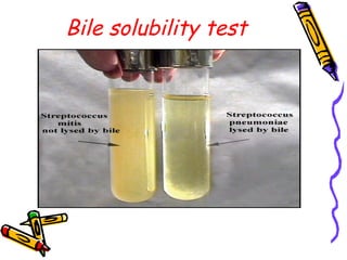 Bile Solubility Test