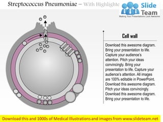 Streptococcus pneumoniae medical images for power point | PDF