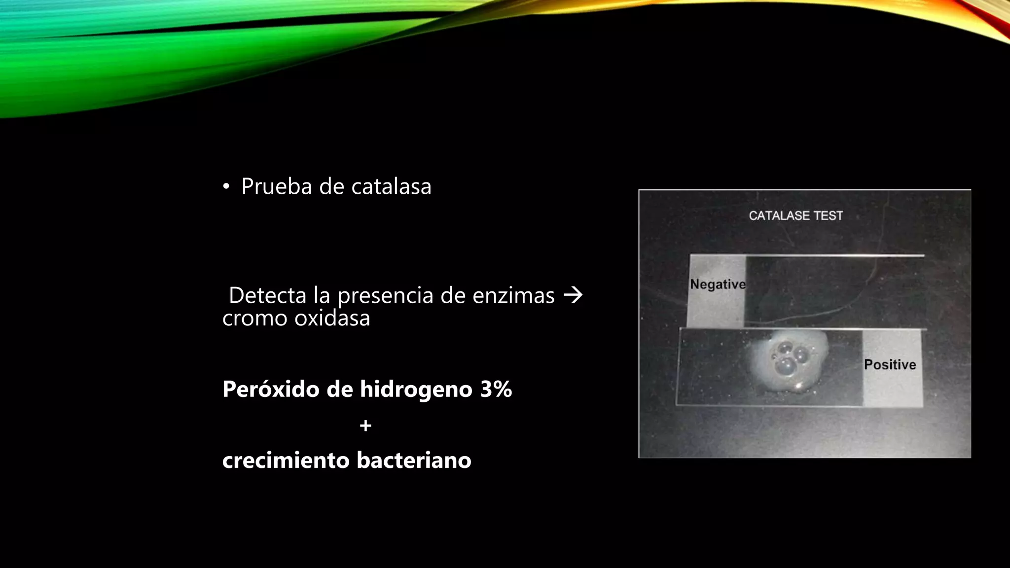 Streptococcus pneumoniae, staphylococcus aureus | PPT