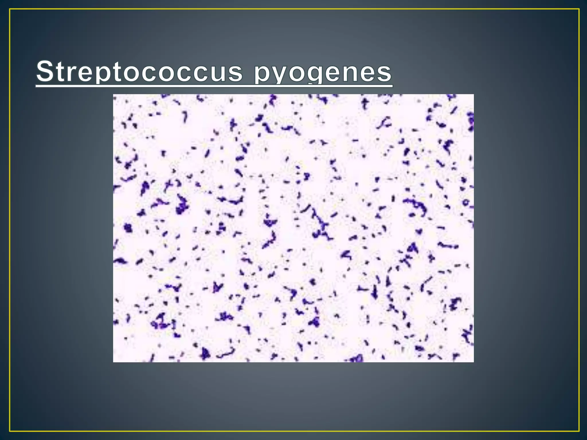 Streptococcus pyogenes | PPT