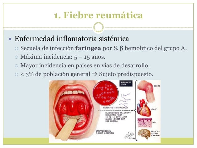 Streptococcus pyogenes
