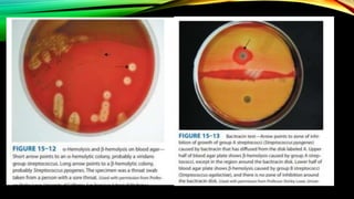 Streptococcus Pyogenes Bacteria Microbiology Lecture | PPTX
