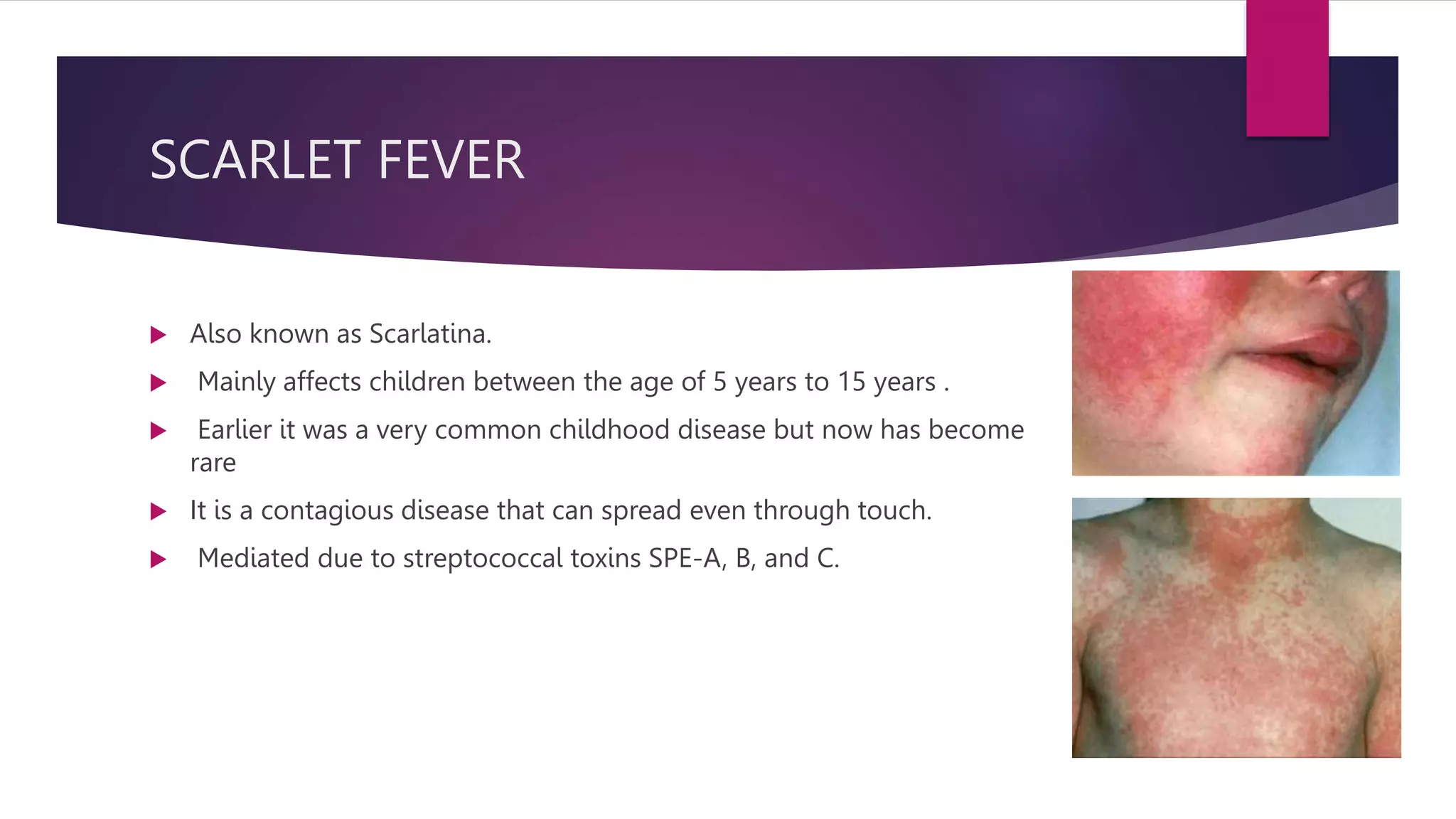 STREPTOCOCCUS PYOGENES.pptx