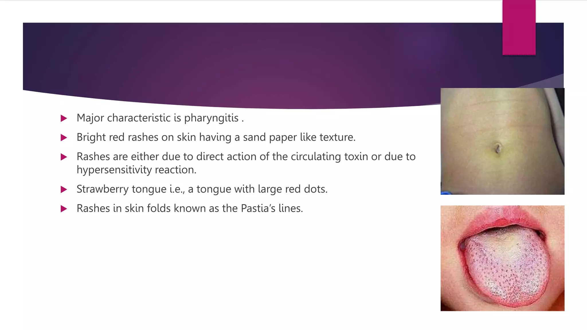 STREPTOCOCCUS PYOGENES.pptx