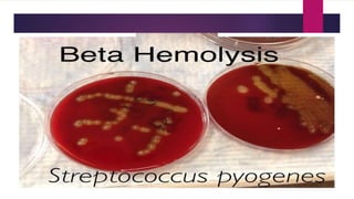 STREPTOCOCCUS PYOGENES.pptx
