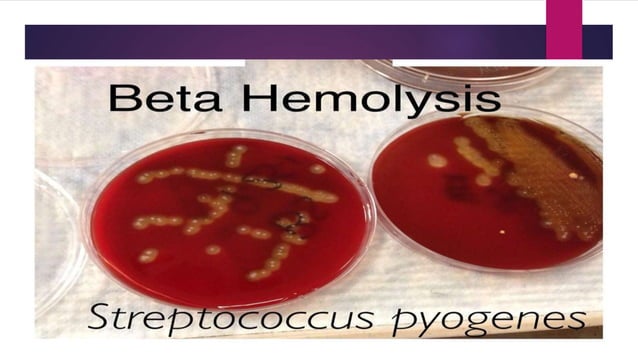 STREPTOCOCCUS PYOGENES.pptx