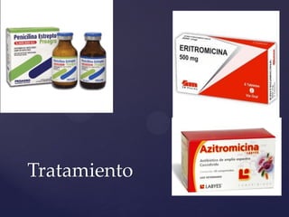Streptococcus pyogenes | PDF