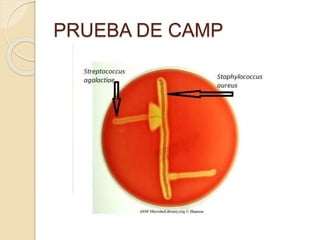 Streptococcus (pyogenes, neumo, agalact y entero) | PPTX