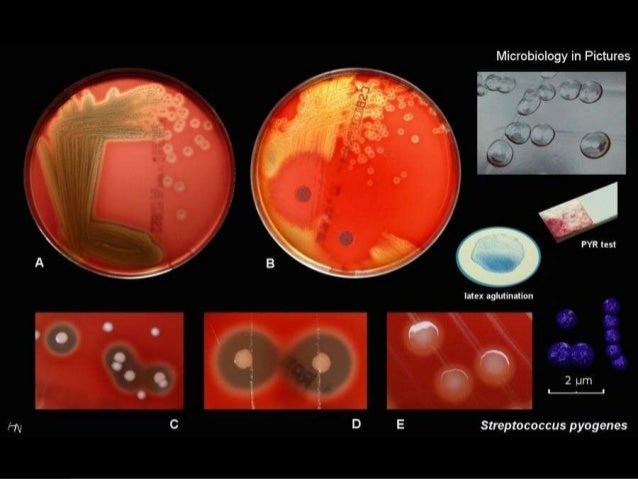 Streptococcus (pyogenes, neumo, agalact y entero)
