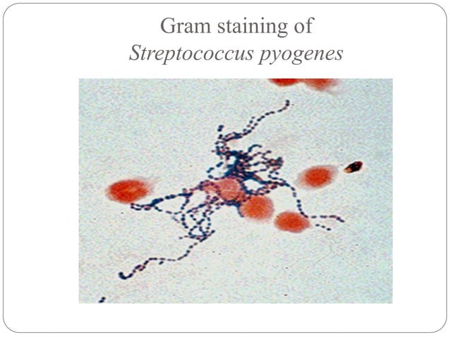 Streptococcus pyogens | PPTX | Infectious Diseases | Diseases and ...