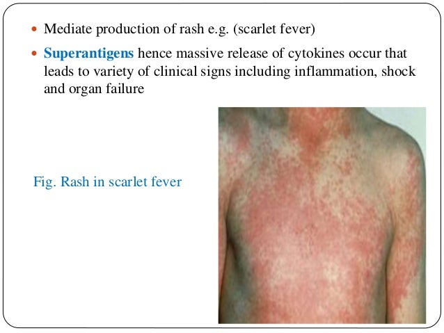 Streptococcus pyogens