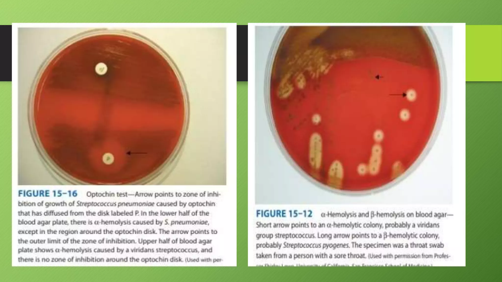 Streptococcus Viridans Bacteria Microbiology Lecture | PPTX