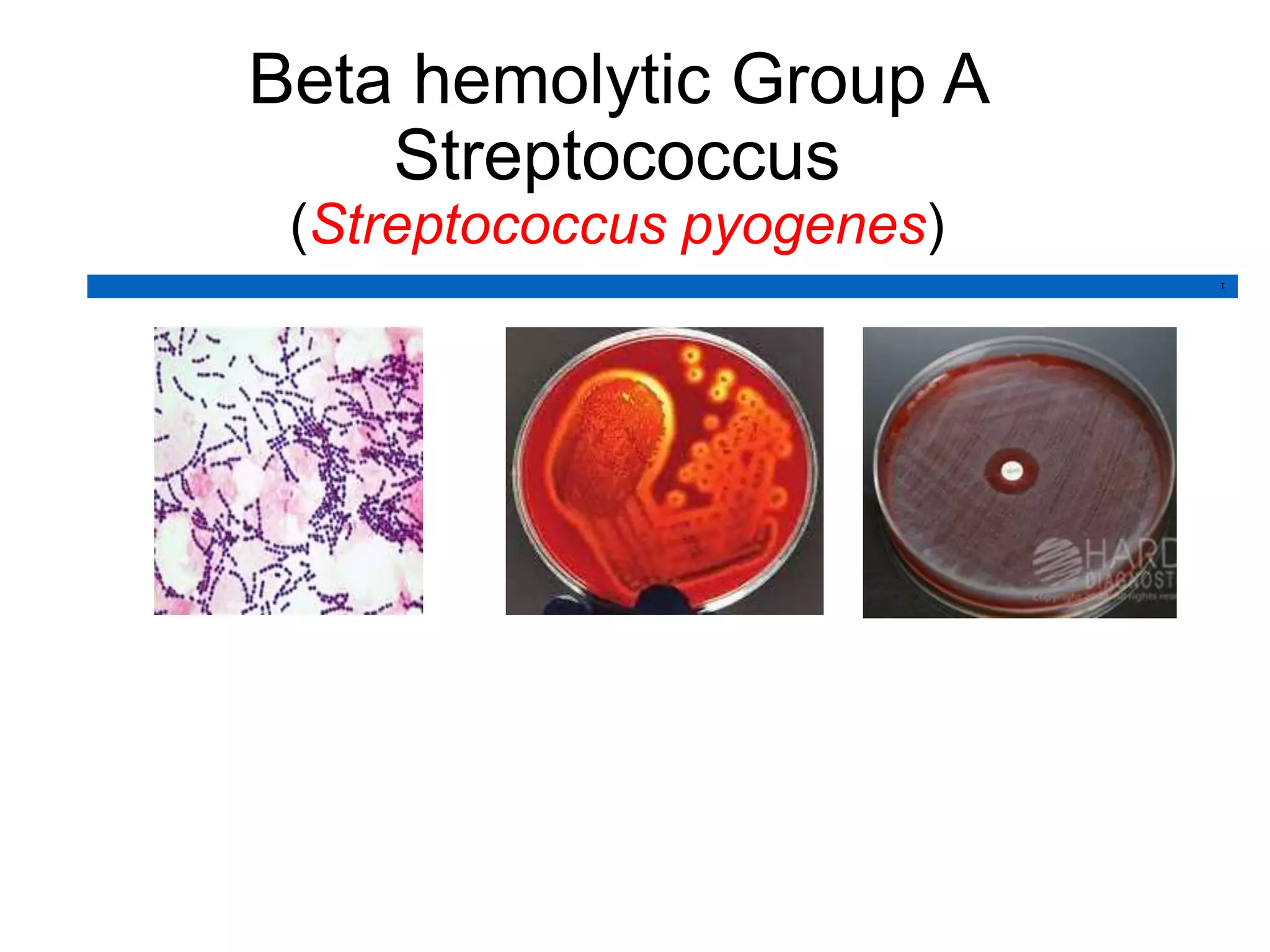 Streptococcus ldentification | PPTX | Ear, Nose and Throat Conditions ...