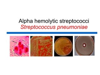 Streptococcus ldentification | PPTX | Ear, Nose and Throat Conditions | Diseases and Conditions