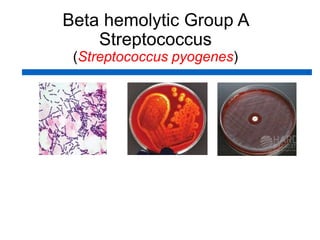 Streptococcus ldentification | PPTX | Ear, Nose and Throat Conditions ...