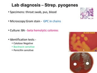 Streptococcus ldentification | PPTX | Ear, Nose and Throat Conditions ...