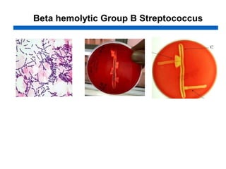 Streptococcus ldentification | PPTX | Ear, Nose and Throat Conditions ...